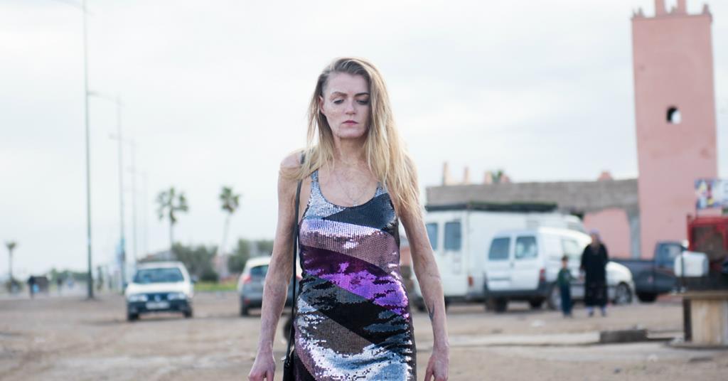 Sacha Polak talks acid attack drama 'Dirty God' ahead of Rotterdam ...