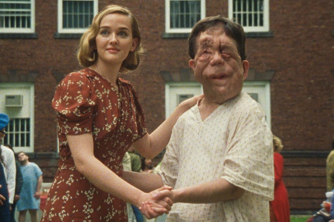 Adam Pearson calls on casting directors to be bolder when considering ...